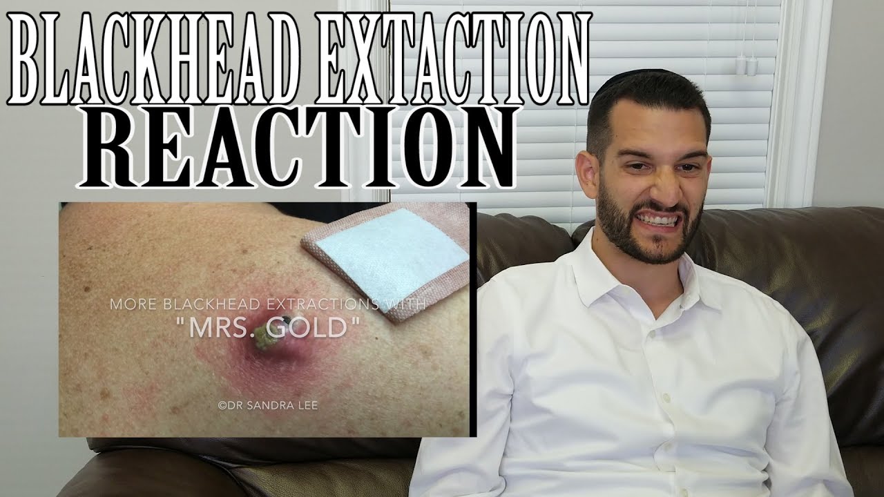 Reaction Video to Dr Pimple Popper - Pop That Zit - Since 2006!