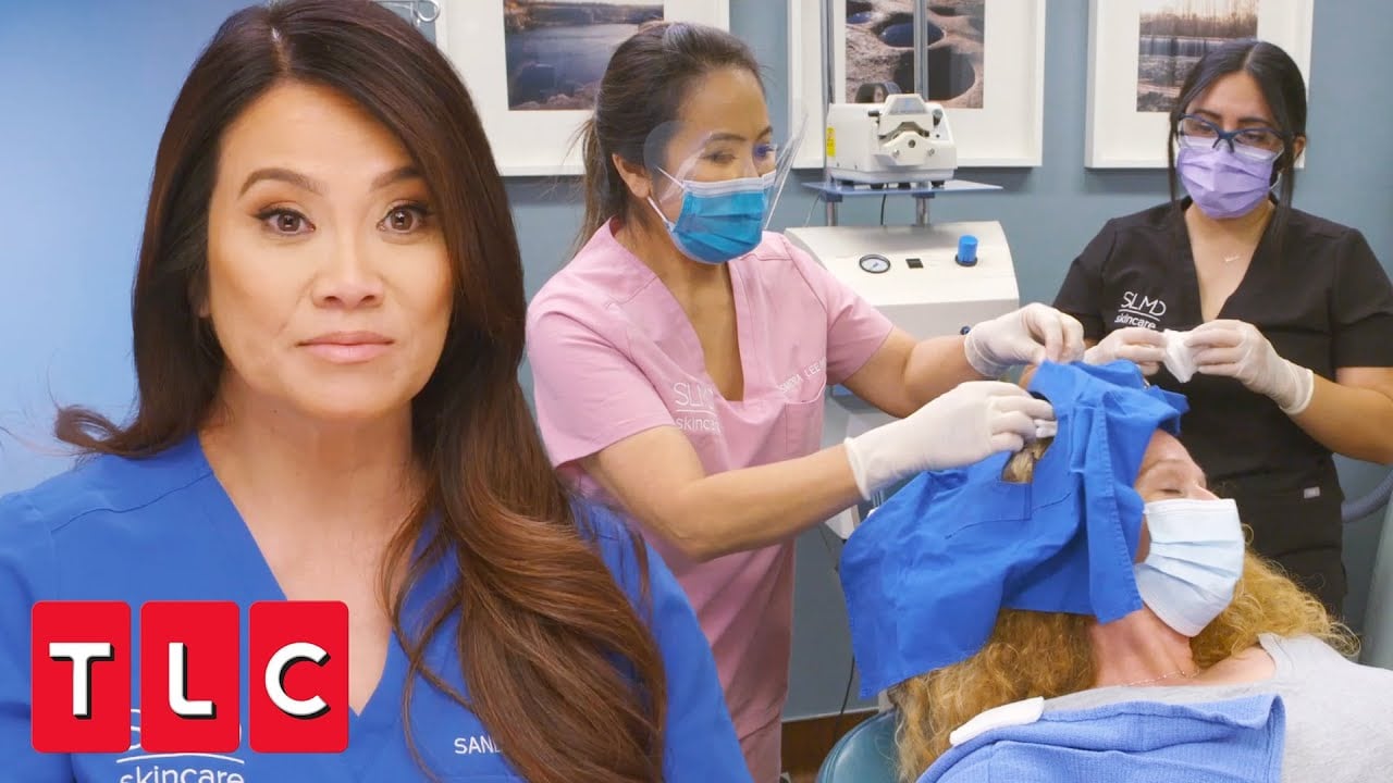 Removal of Pilar Cysts - Pop That Zit - Since 2006!